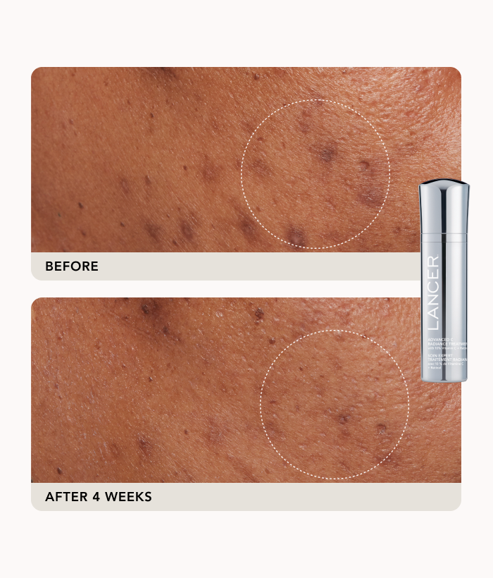 Dr. Lancer's Method | Lancer Skincare | Regenerative Skin Intelligence